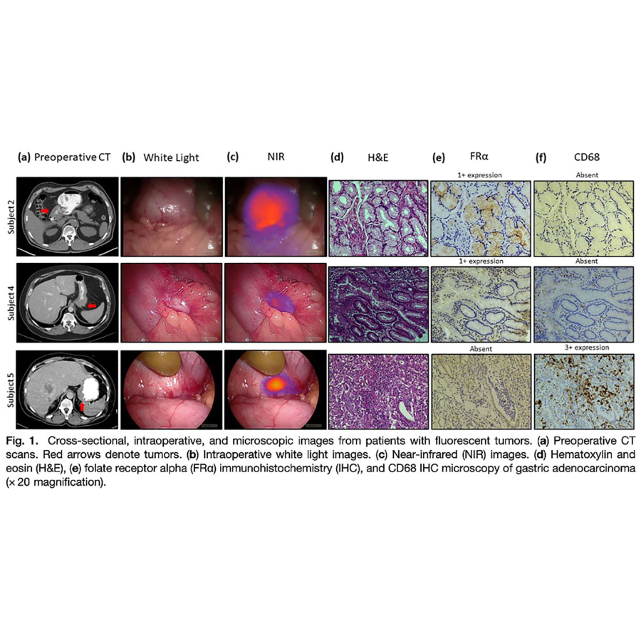 home testing | World Molecular Imaging Society
